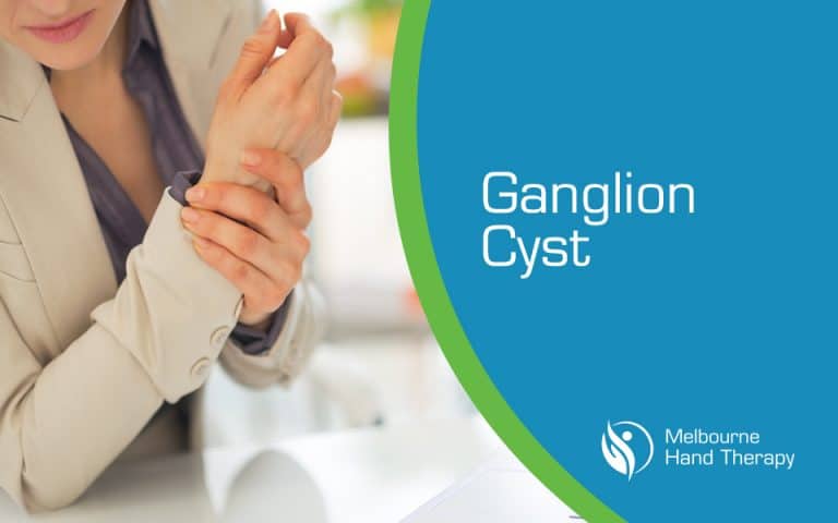 Ganglion Cyst: Symptoms, Causes & Treatment | Melbourne Hand Therapy