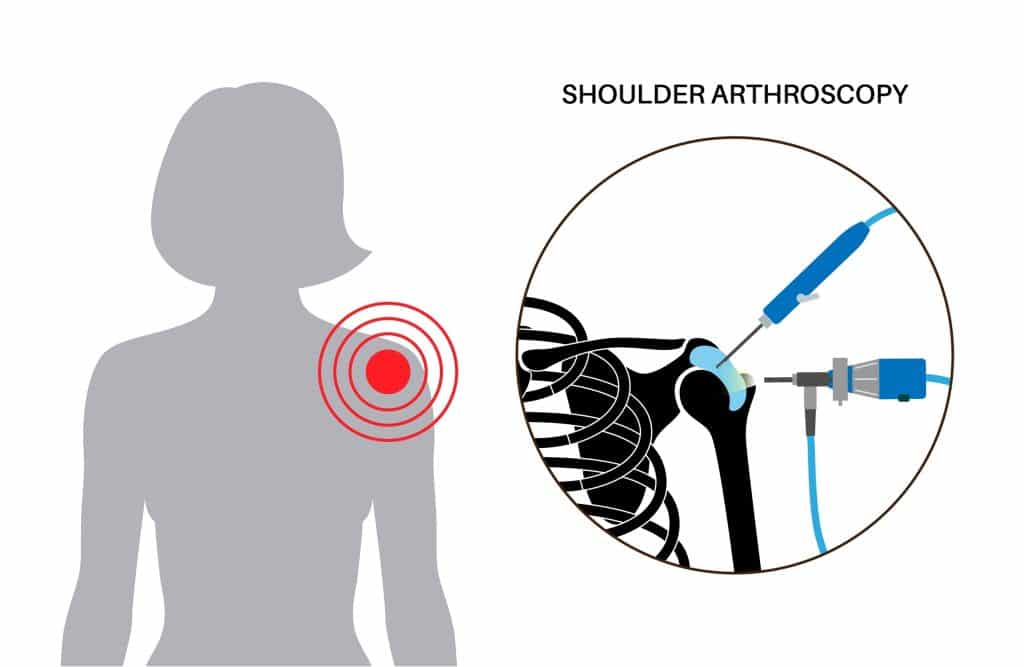 Advanced Techniques for Healing Tendon Injuries