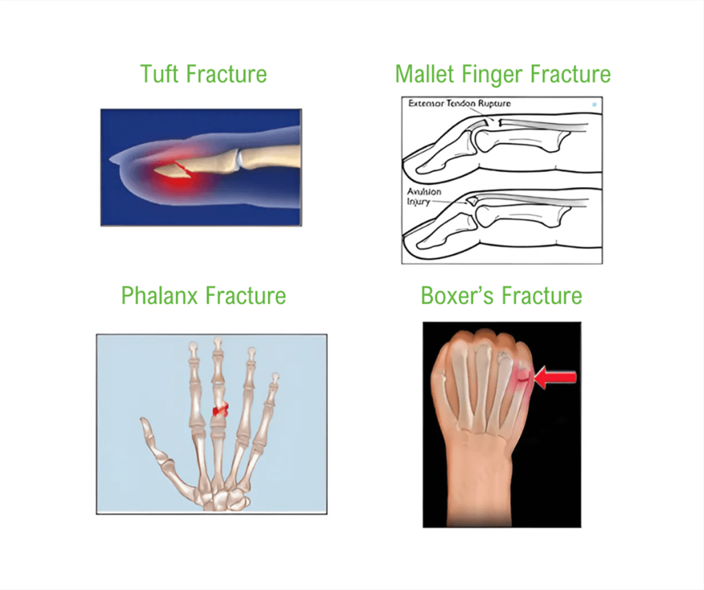 July 2025 Updates & News | Melbourne Hand Therapy